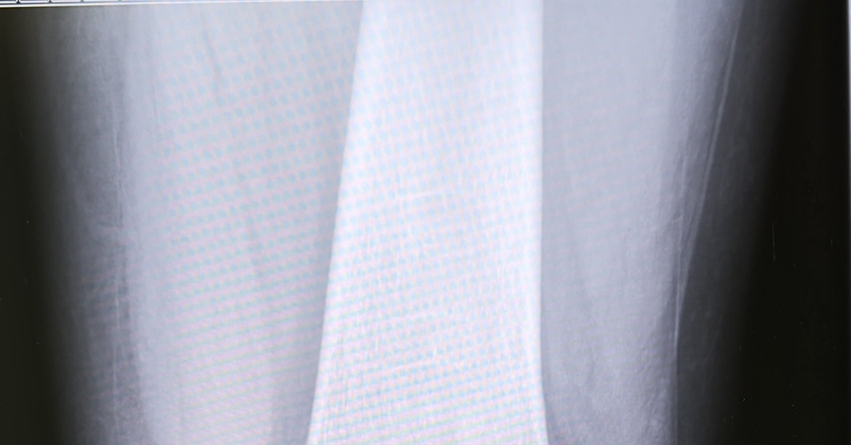 Os fabella - 21.08.24 18:48 | Пикабу